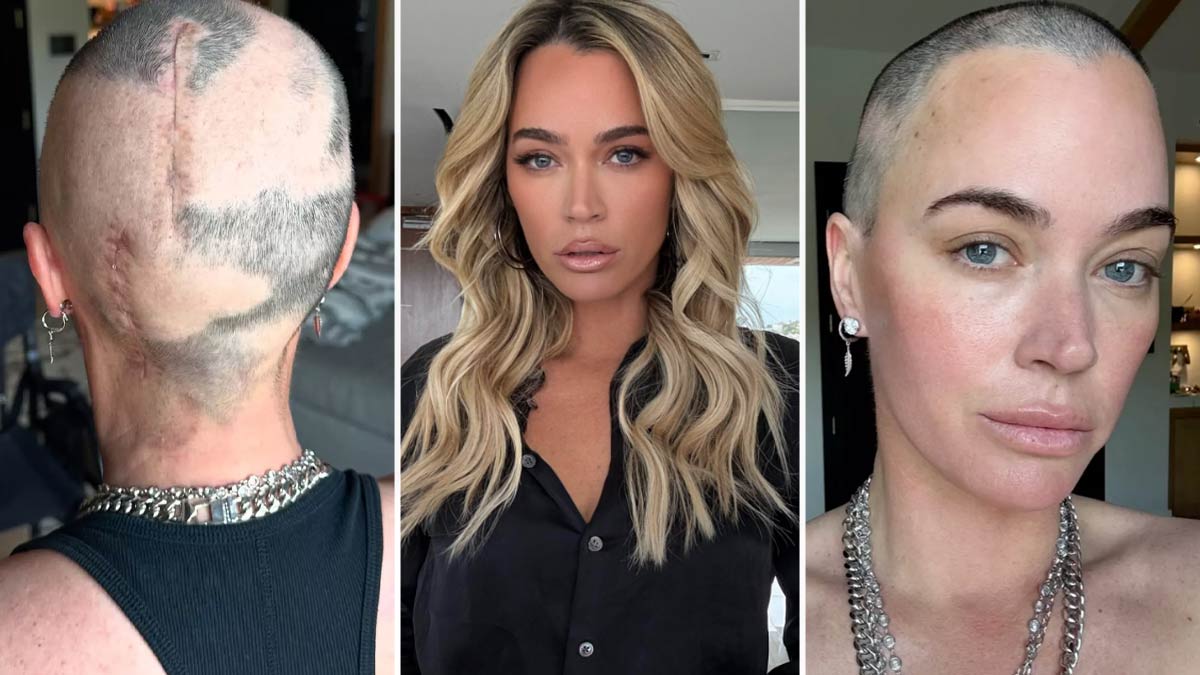 Real Housewives’ Teddi Mellencamp Opens Up About Stage 4 Cancer and ...