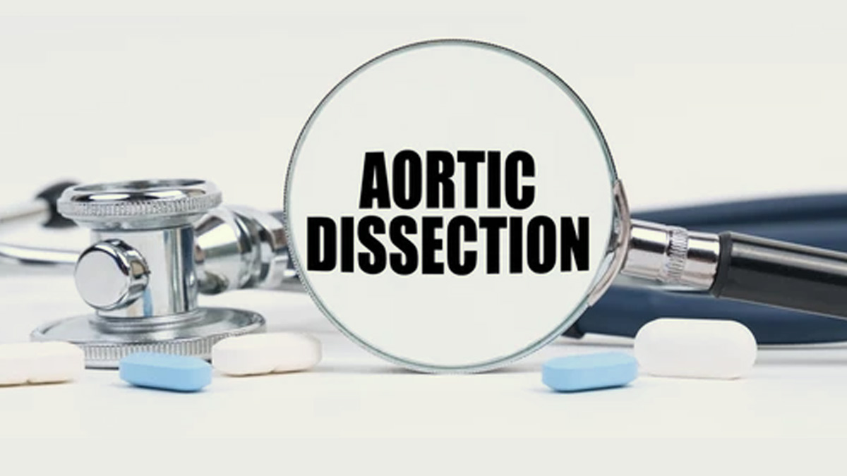 Aortic Dissection Explained: Causes, Symptoms, Diagnosis And Treatment ...
