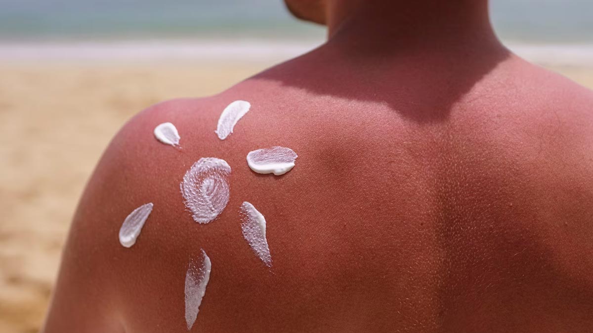 National Sunscreen Day 2025: What Is SPF And Should You Choose SPF 30 ...