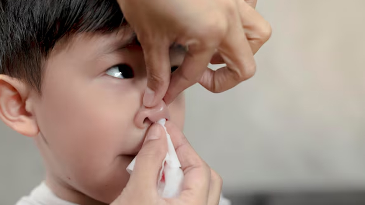 Nosebleeds In Children: From Most Common To Rare Causes | OnlyMyHealth