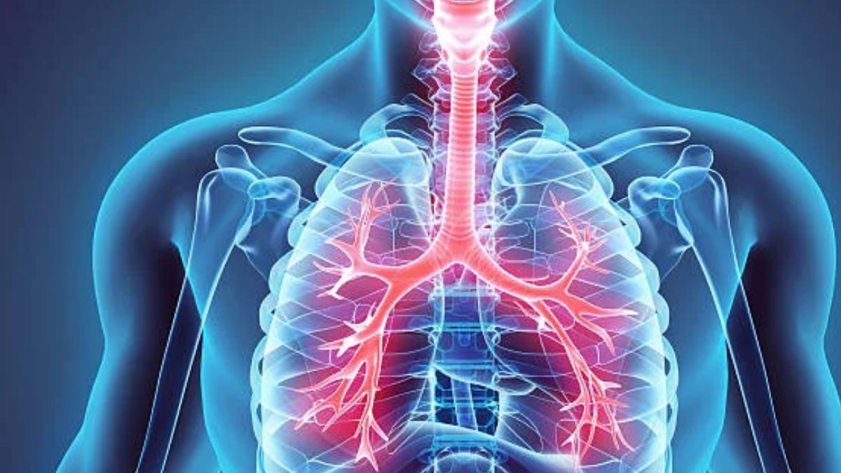 Understanding Bronchial Asthma and Its Winter Triggers After Sonia ...