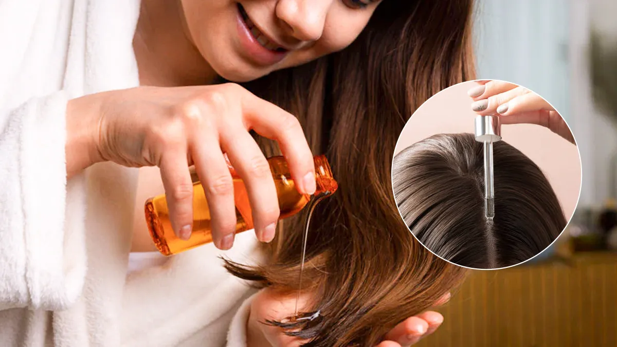 Does Oiling Hair Increase Dandruff? Here’s What Dermatologist Says ...