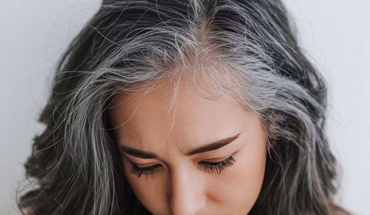 Can Grey Hair Turn Black Again? Here's What Dermatologist Says ...
