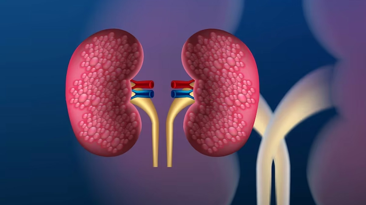 Plant-Based Proteins May Lower the Risk of Kidney Disease, Study Finds ...