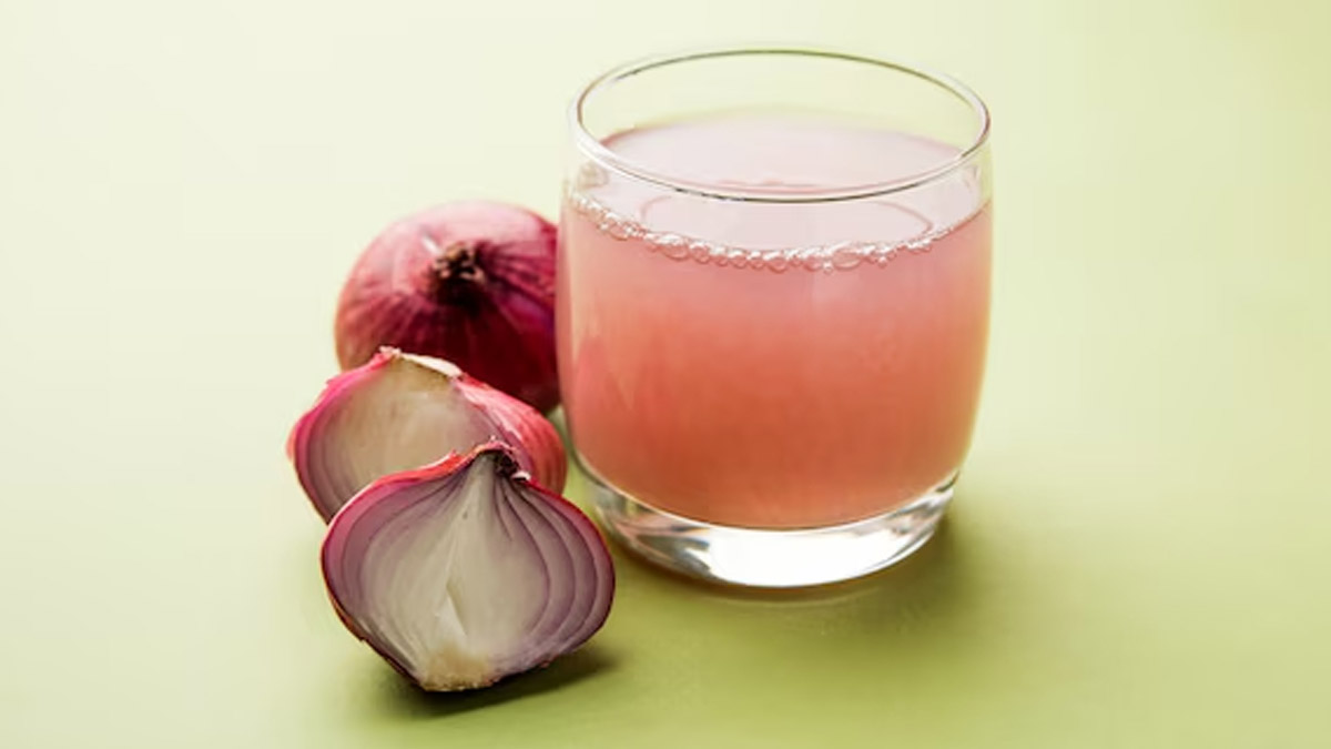 Want Glowing Skin? Expert Shares DIY Onion Face Packs | OnlyMyHealth