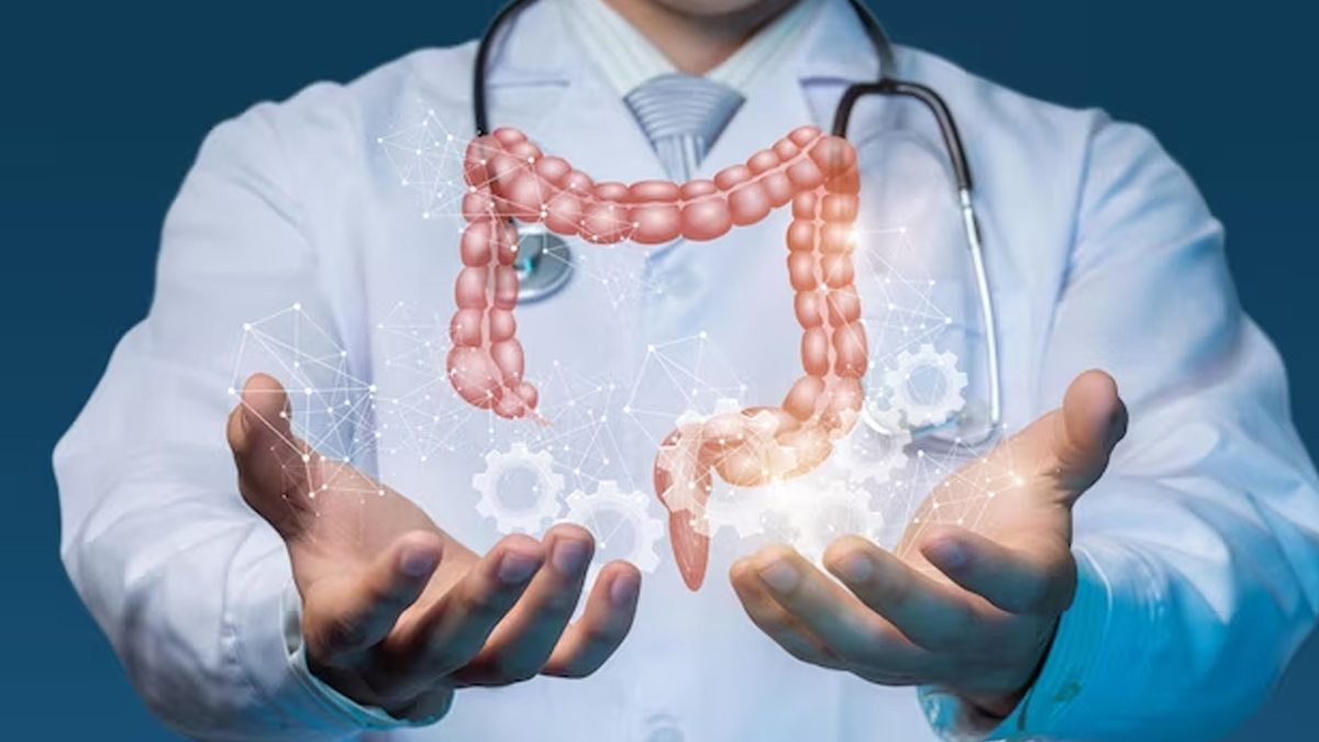 Colorectal Cancer Emerges as Deadliest Cancer for People Under 50: Know ...