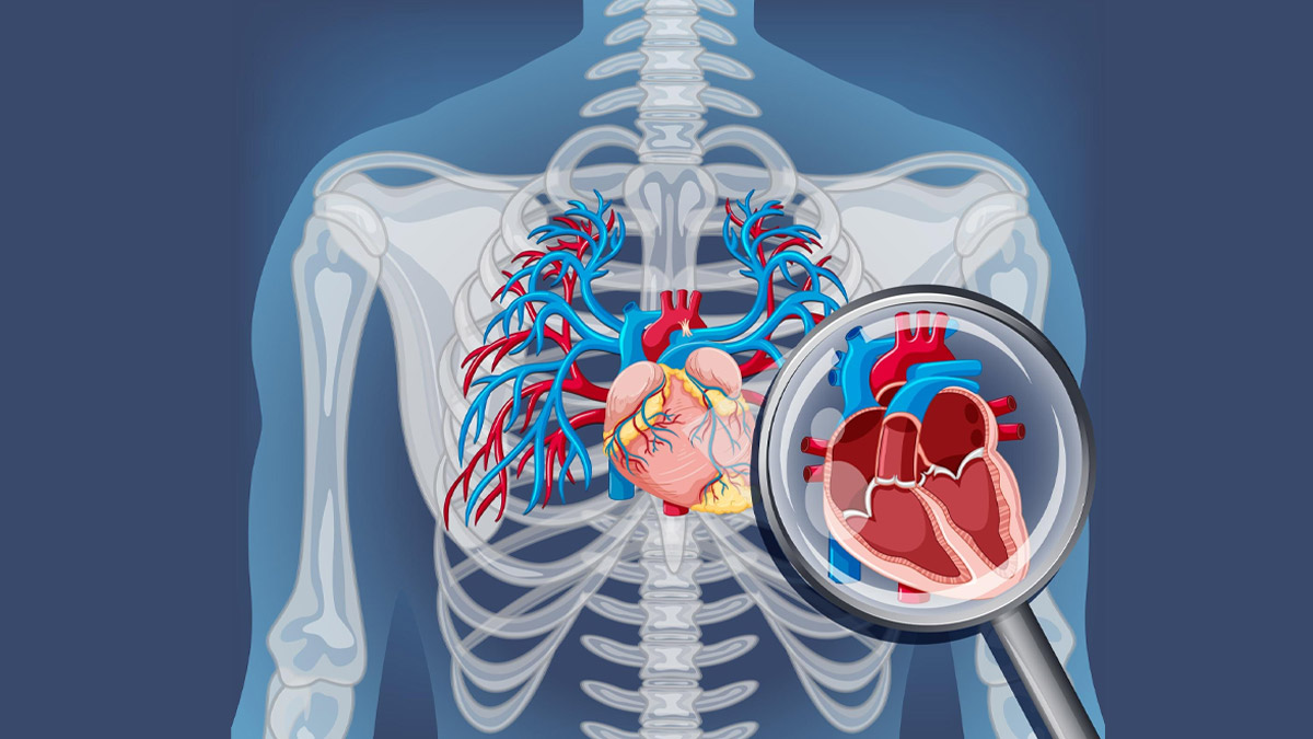 Cardiologist Warns About Sudden Chest Pain and How TEVAR Can Save Lives ...
