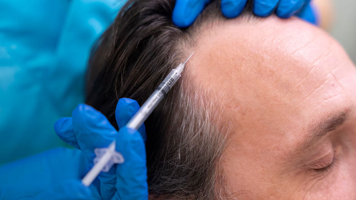 Medical vs Cosmetic Hair Treatments: Which One Do You Actually Need ...
