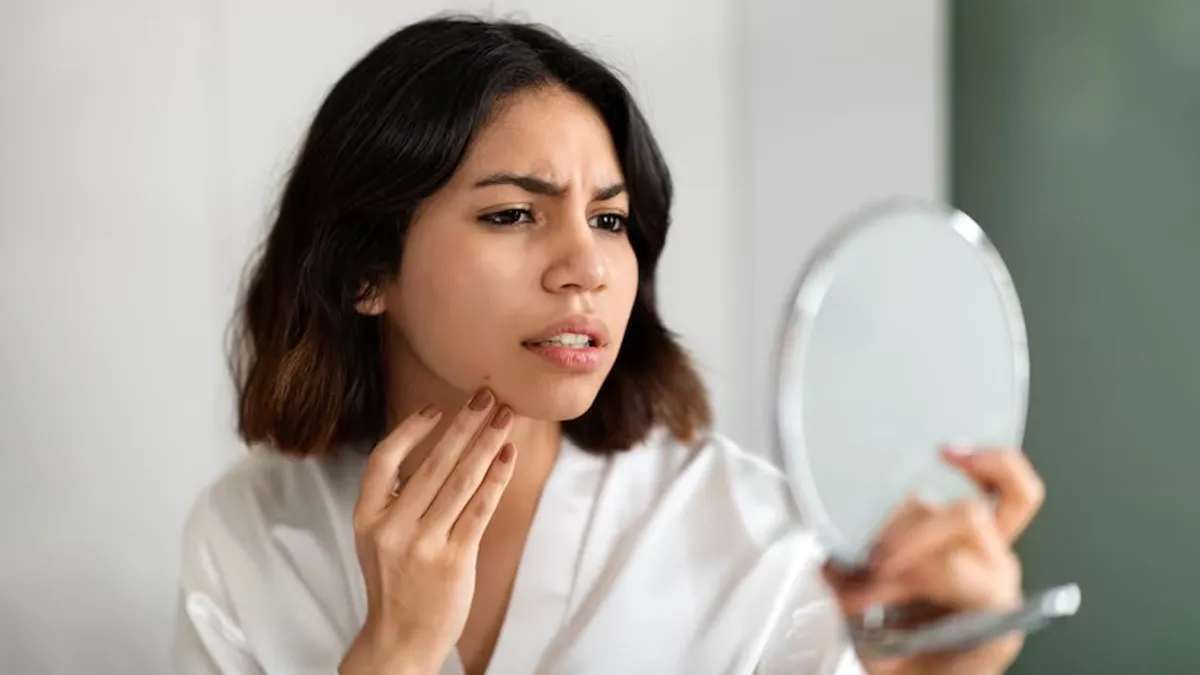 3 Best Ways to Heal Your Face After Over-Exfoliating, Dermat Shares ...