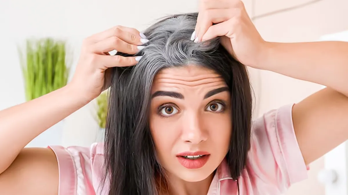 Grey Hair In Your 20s? Why Nutritional Deficiency Might Be To Blame ...