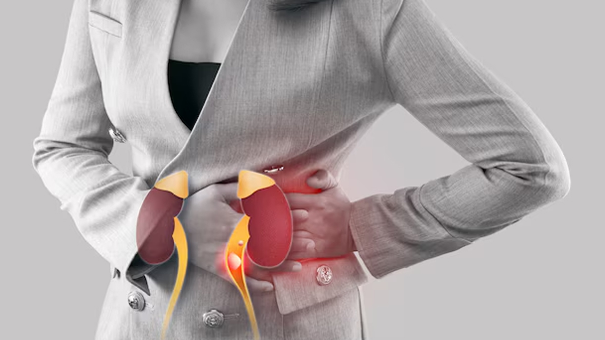 Where Do Kidney Stones Actually Hurt? Doctors Explain | OnlyMyHealth