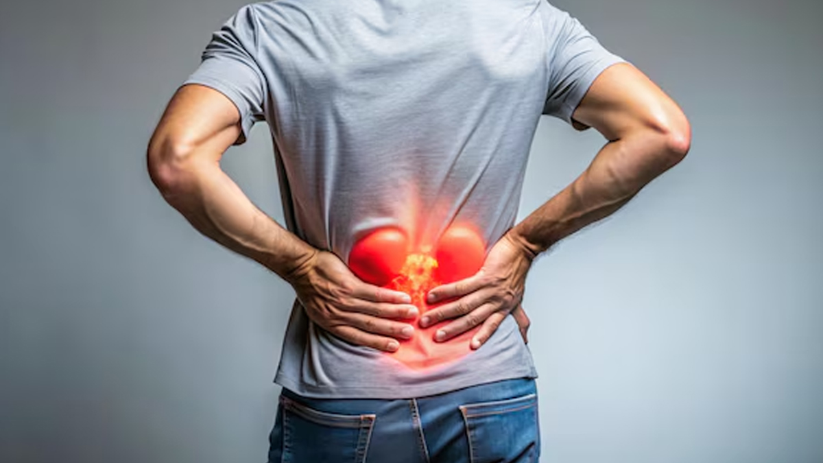 Where Do Kidney Stones Actually Hurt? Doctors Explain | OnlyMyHealth