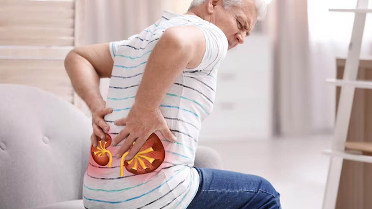 Where Do Kidney Stones Actually Hurt? Doctors Explain | OnlyMyHealth