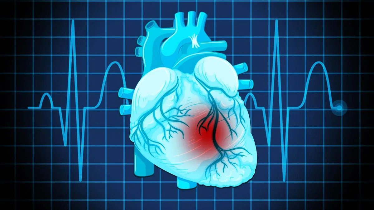 Coronary Artery Disease (CAD): Symptoms, Causes, And Treatment ...