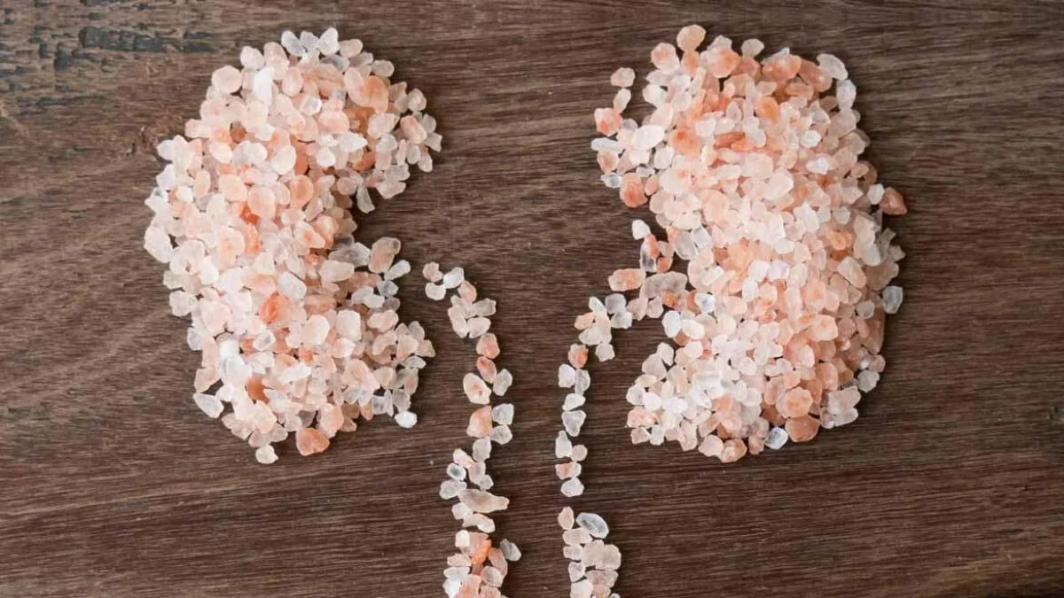 Can Too Much Salt Cause Kidney Stones? Here Is What An Expert Suggests ...