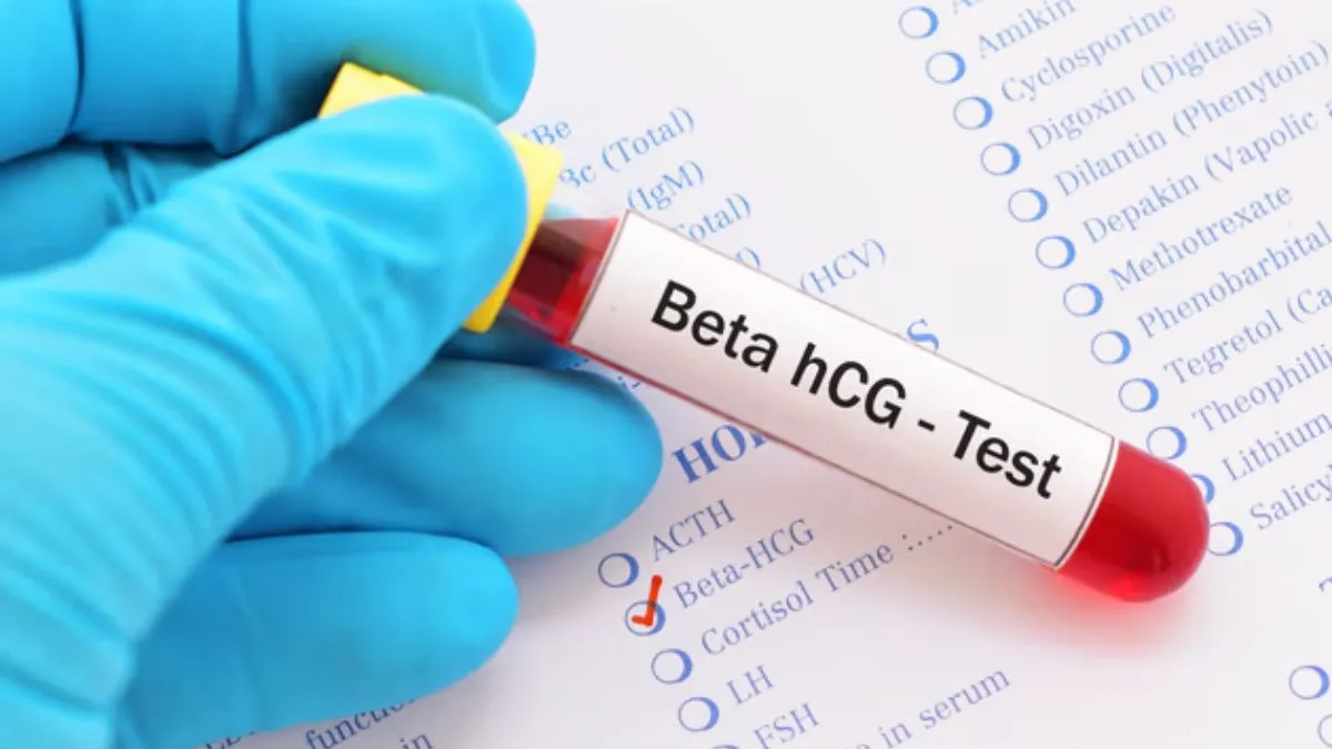 Beta-HCG Levels in Pregnancy: What Is Normal and What the Numbers ...