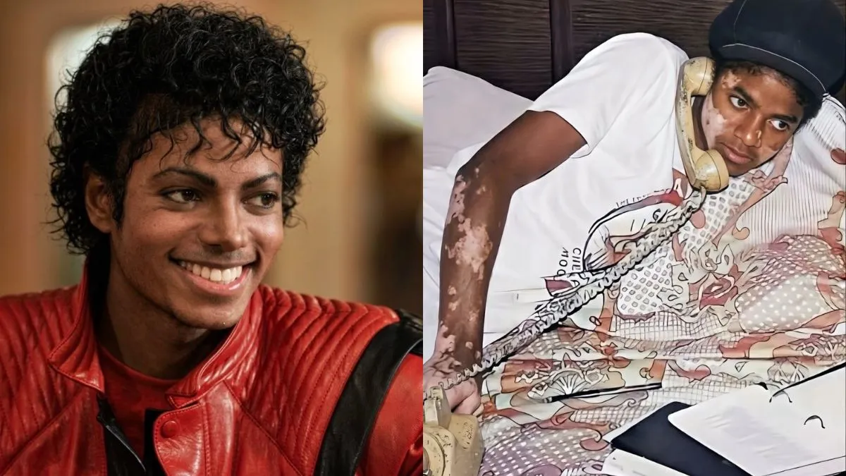 Why Did Michael Jackson's Skin Turn White? The Truth About Vitiligo and ...