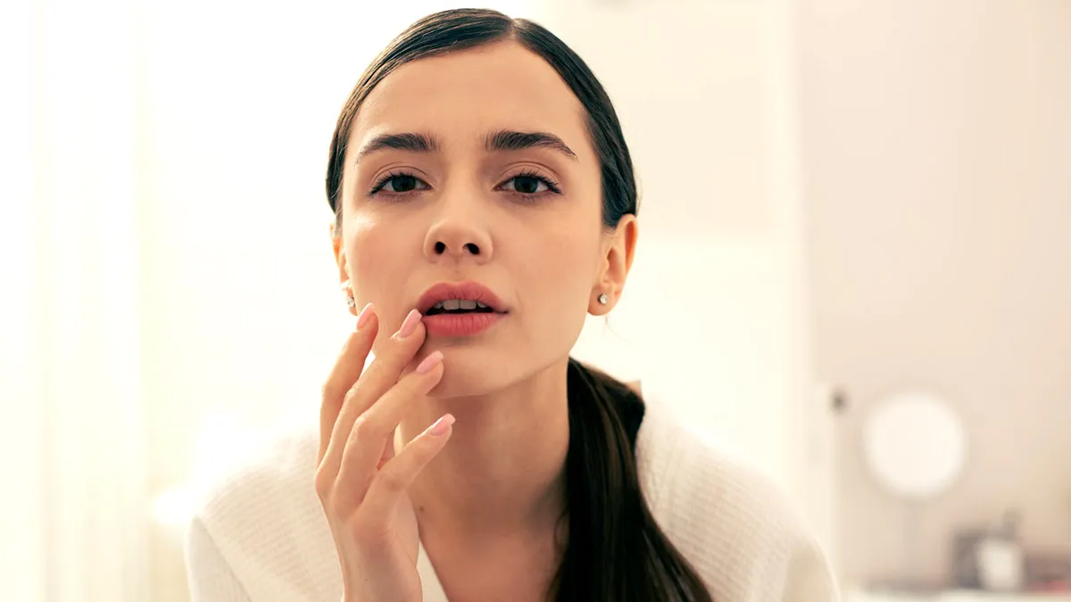 Chapped Lips: Expert Tips to Heal Dry, Cracked Lips Fast | OnlyMyHealth