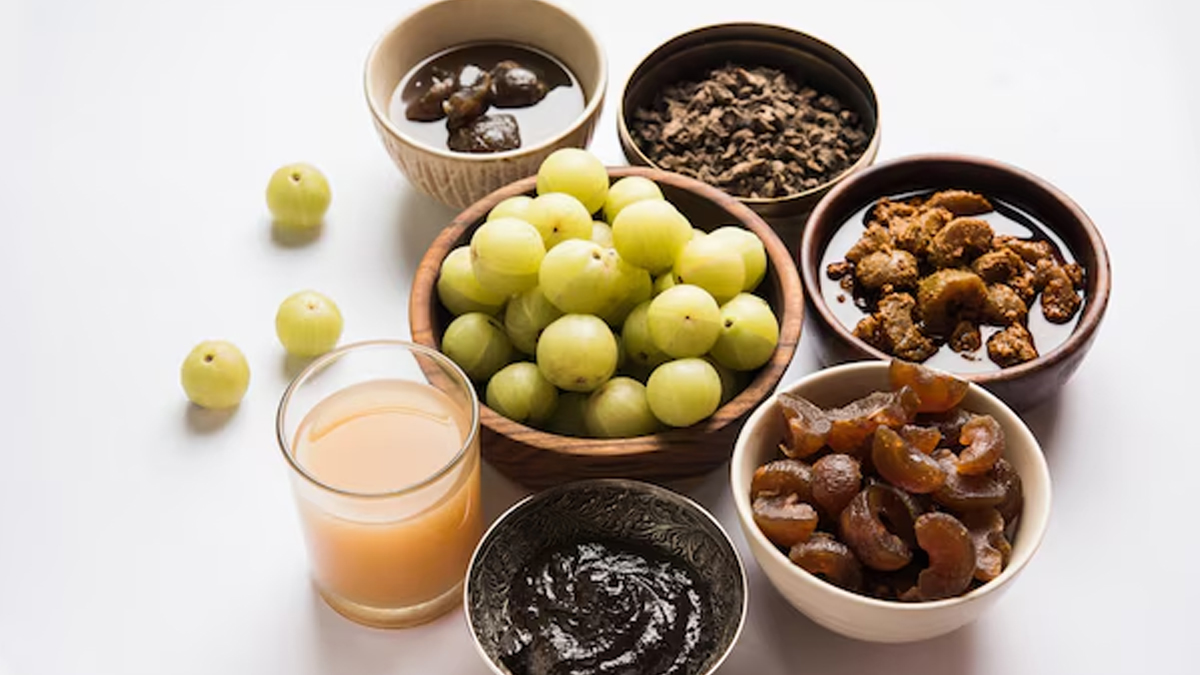 Can You Eat Sour Foods in Periods? Expert Busts Myth | OnlyMyHealth