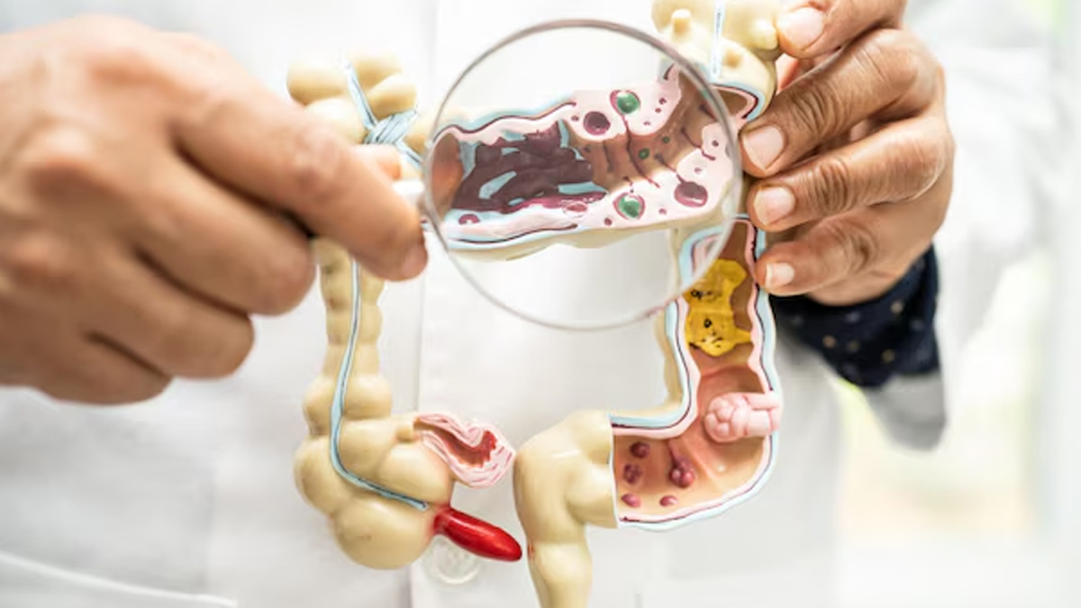 आंत उतरने के क्या लक्षण हैं? डॉक्टर से जानें कारण और बचाव के उपाय ...