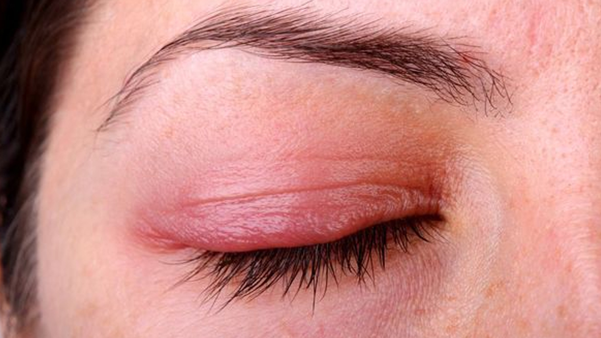 Does Menopause Affect Your Eyes? Exploring How Naomi Watts Ignored Her ...