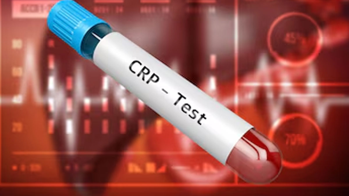 C-reactive protein (CRP) टेस्ट क्यों किया जाता है और इसके बढ़ने-घटने का ...