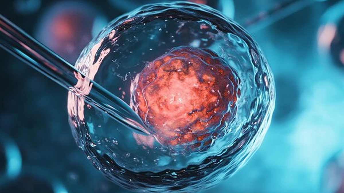 IVF ट्रीटमेंट के दौरान कुछ लोगों को पेट फूलने की समस्या (ब्लोटिंग ...
