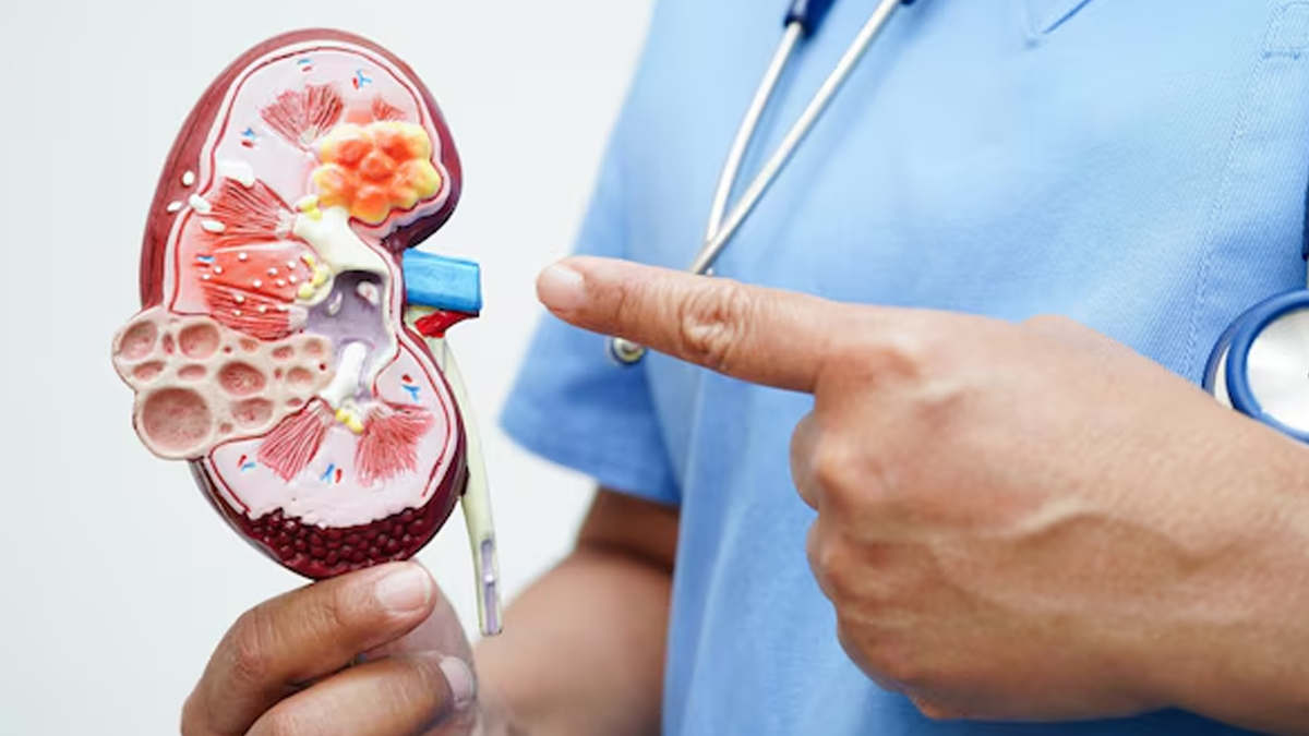 क्या स्टेज 1 CKD पूरी तरह ठीक हो सकता है? जानें क्या कहते हैं डॉक्टर ...