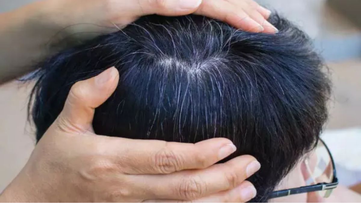 White Hair In Kids 
