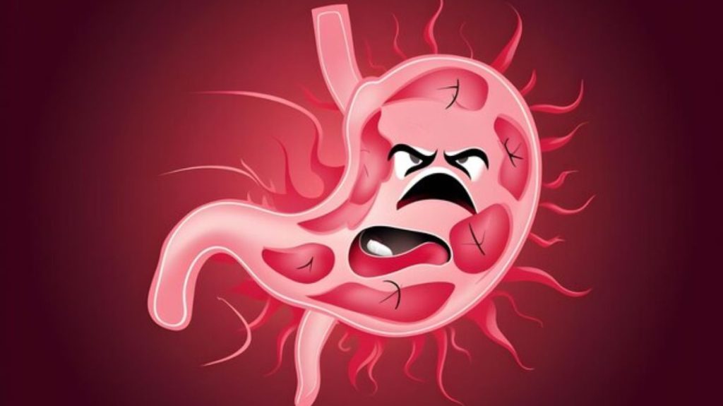Stomach Ulcer Remedies ஆயுசுக்கும் அல்சர் தொல்லை இல்லை அதான் இது இருக்கே Onlymyhealth