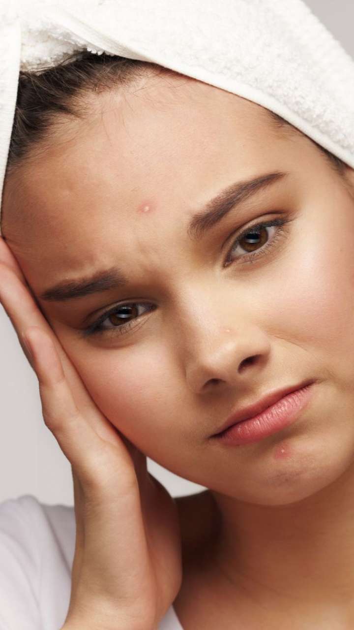 6 Skincare Mistakes That Can Cause Acne Breakouts