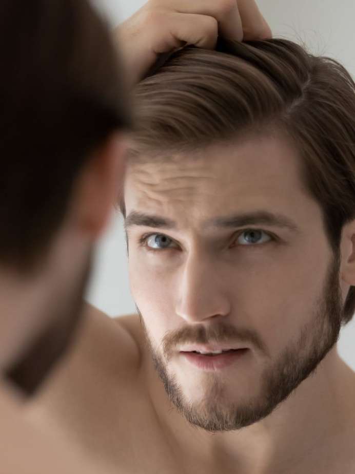 How To Stop Receding Hairline For Young Men Naturally | Onlymyhealth