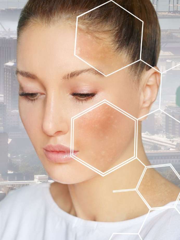 6 Ways To Protect Your Skin Against Pollution Damage | Onlymyhealth