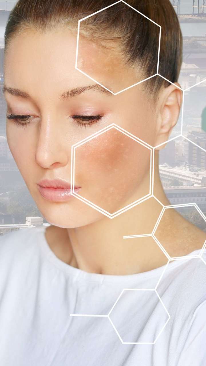 6 Ways To Protect Your Skin Against Pollution Damage