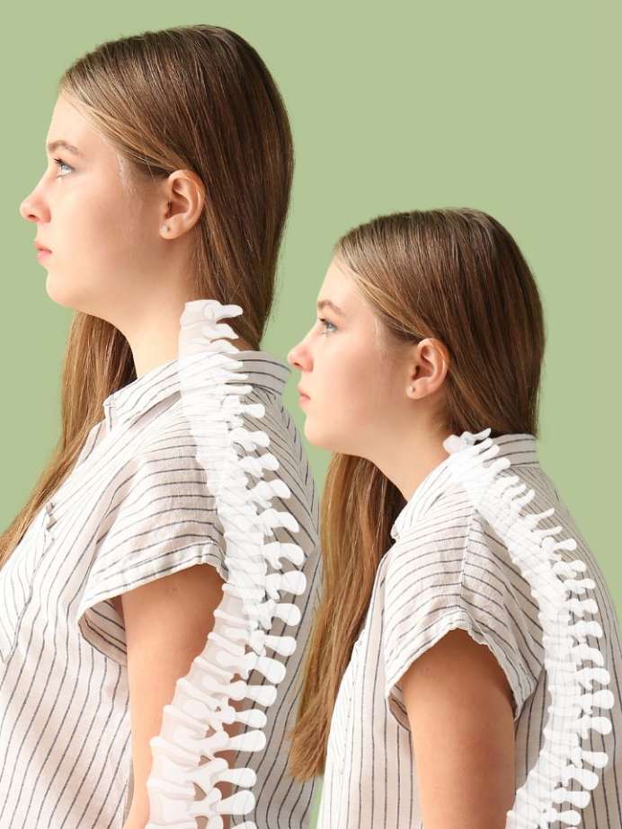 Tips To Maintain A Good Body Posture All Day | Onlymyhealth