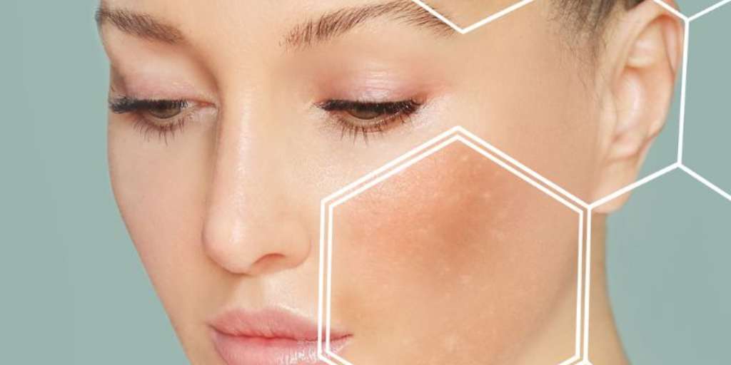 Top 6 Tips To Protect Skin From Pollution | Onlymyhealth