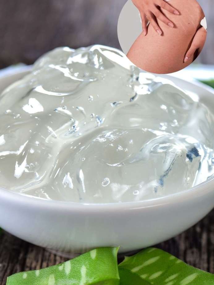 Can Aloe Vera Clear Stretch Marks