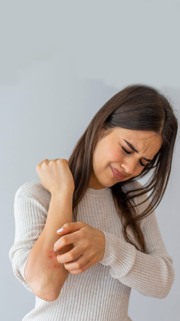 Treat Seasonal Rashes With These Home Remedies