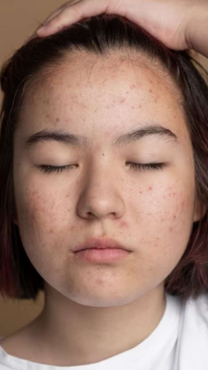 एक्सपायर मेकअप लगाने से क्या होता है?