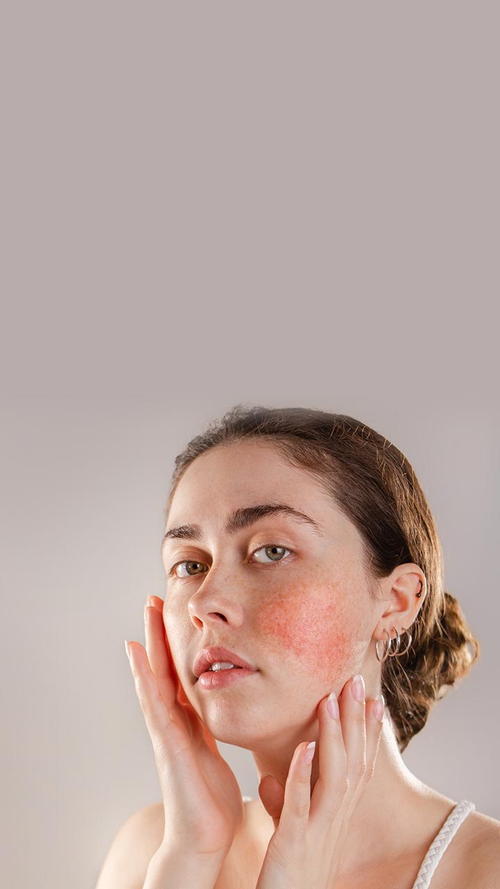 Common Skin Disorders To Look Out For