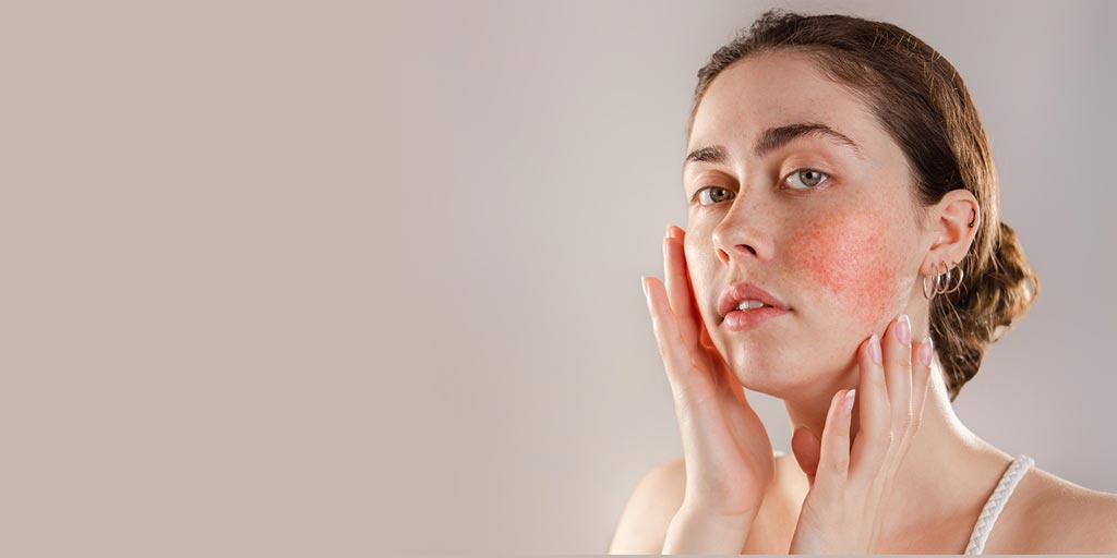 Common Skin Disorders To Look Out For