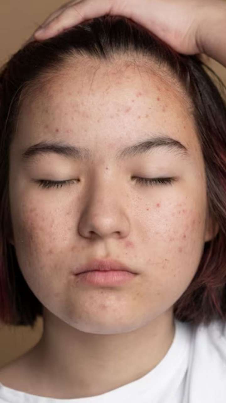 चेहरे पर बढ़ रहे काले धब्बे? इन 5 आदतों में करें सुधार