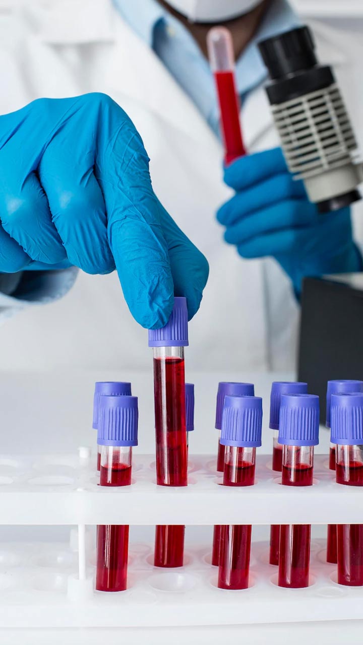 शादी से पहले कराने चाहिए ये 5 मेडिकल टेस्ट