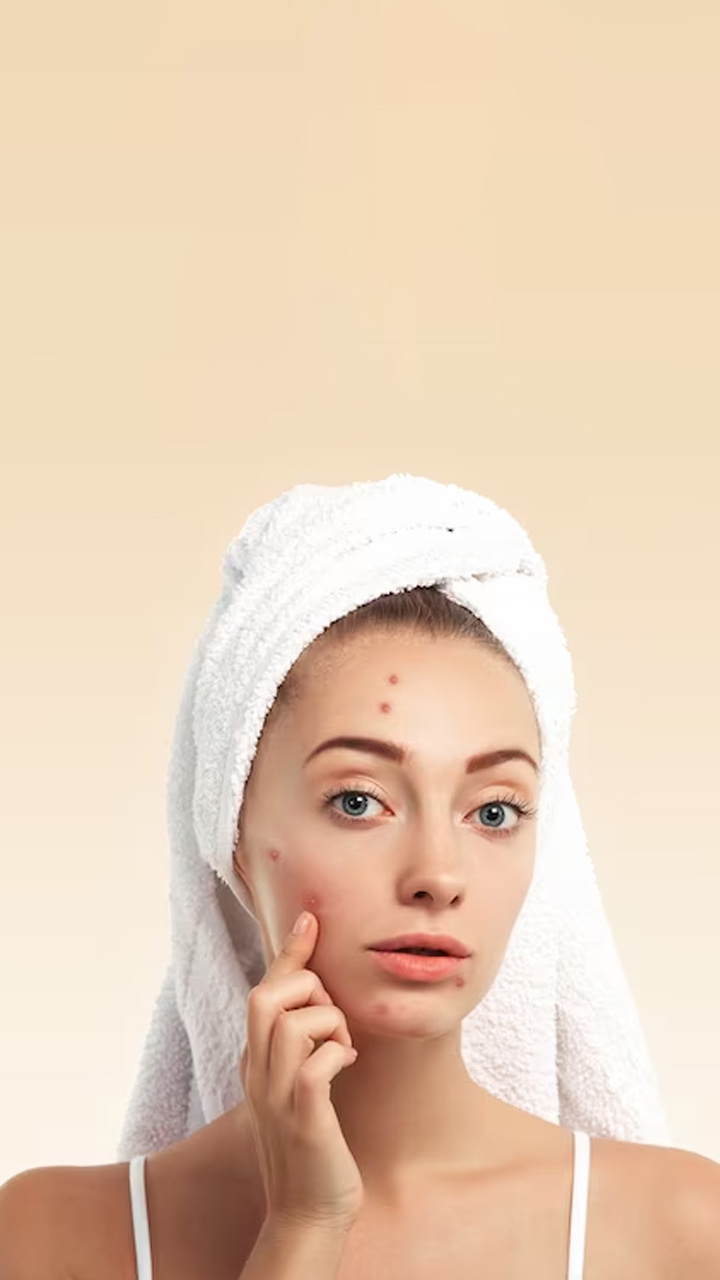 Face Mites: Causes And Treatment