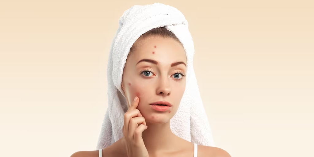 Face Mites: Causes And Treatment