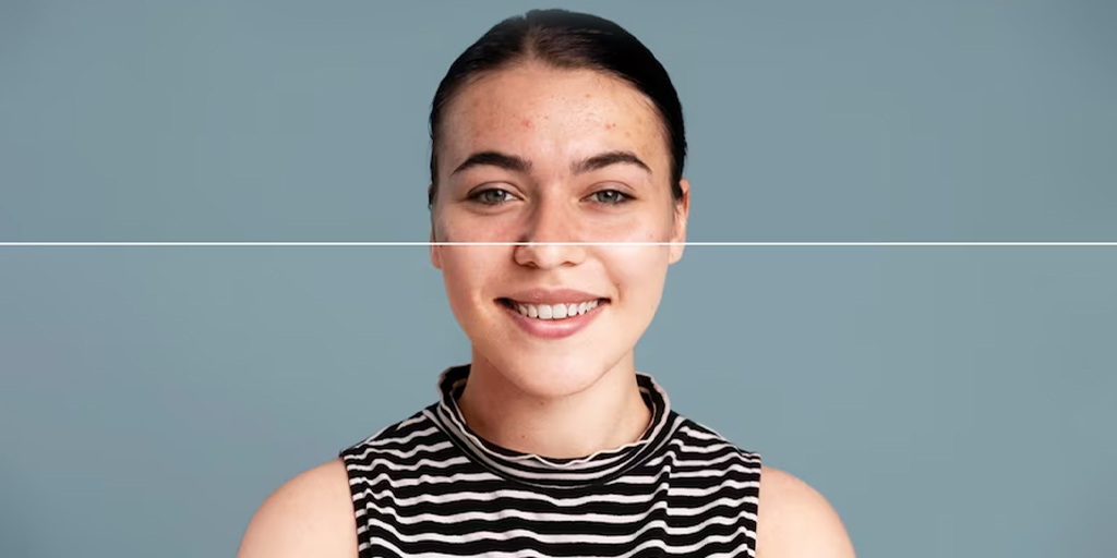 Amazing Tips To Lighten Facial Scars